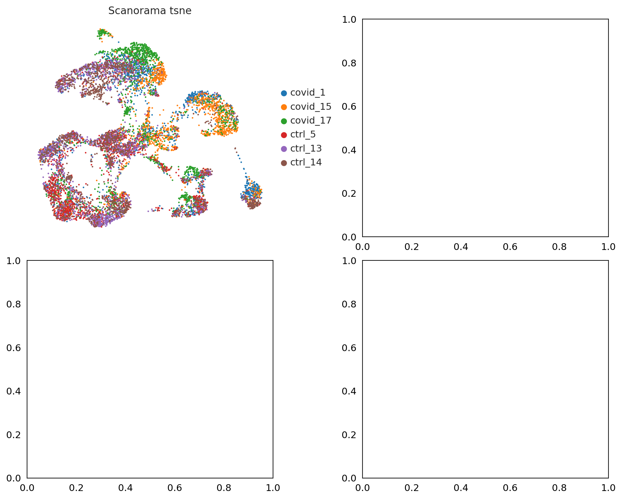Data Integration (Batch correction) — Bioinfozone - Easy way to learn Bioinformatics